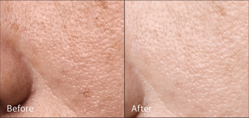 Licorne: Vitafill Toning Pad 170ml/ 70 puder - Velkommen til Namsan